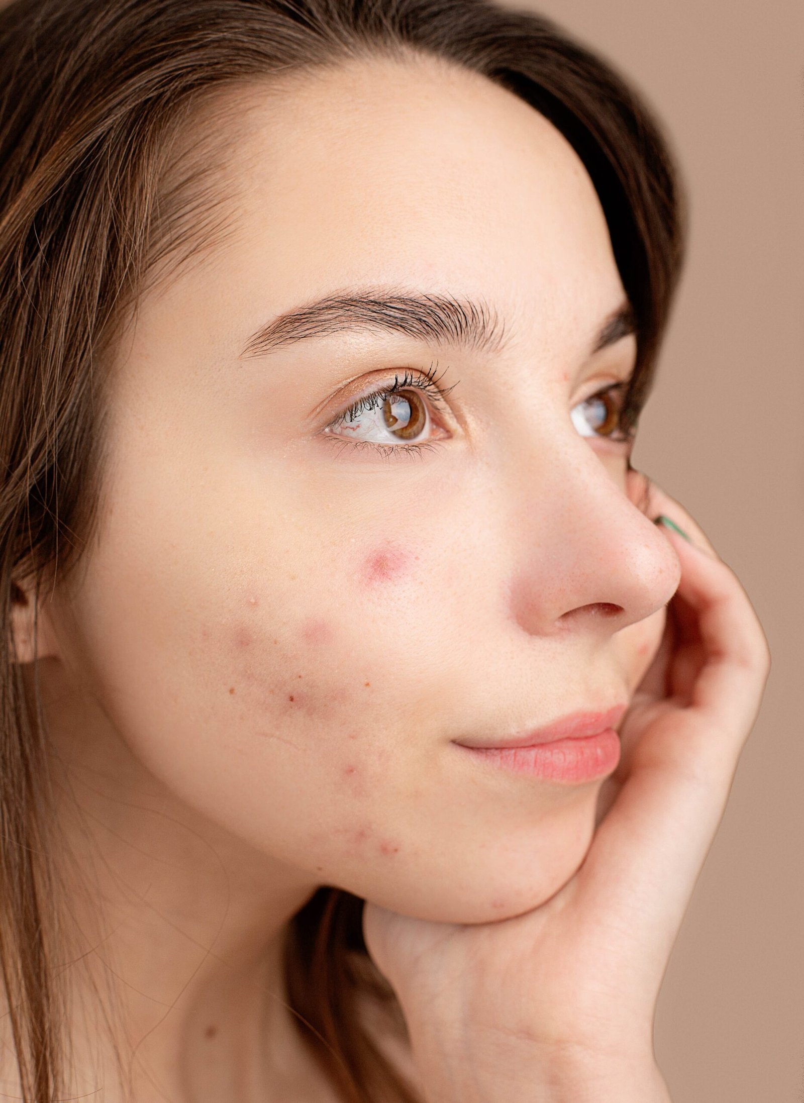 The Truth About Acne The Dermatology Clinic The Truth About Acne The Dermatology Clinic